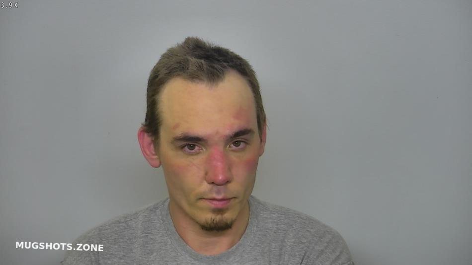 WOHL NATHANIEL RAYMOND 03/11/2024 - Burleigh County Mugshots Zone