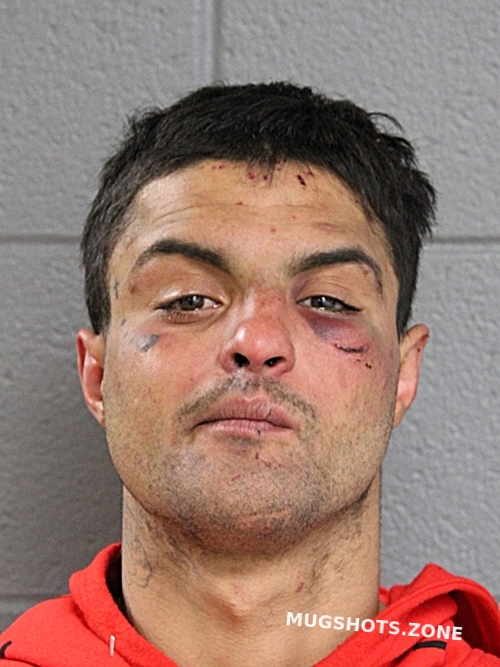ORLANDO ANTHONY DAVILA MILLET 04/07/2025 - Chicago Mugshots Zone