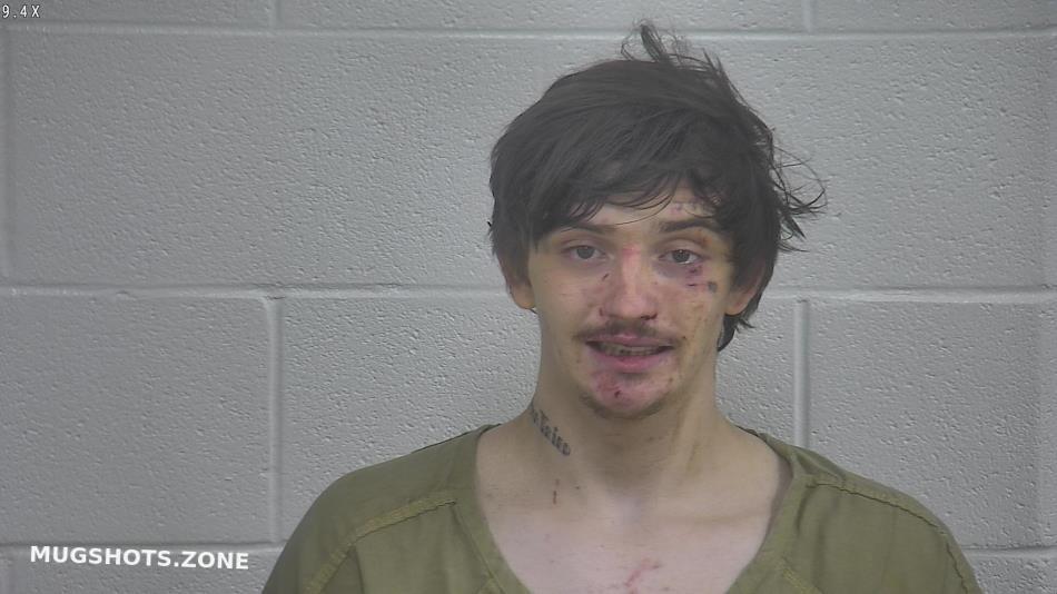 HUBBARD SKYLER 03/31/2025 - Laurel County Mugshots Zone