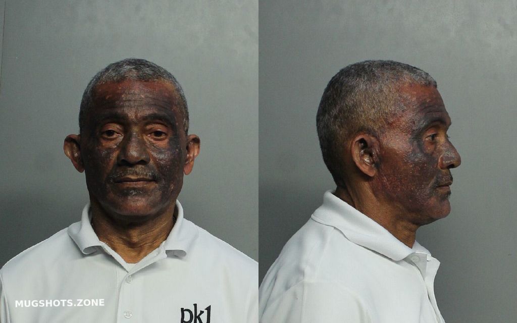 BERNARD RONALD 03/23/2021 - Miami-Dade County Mugshots Zone