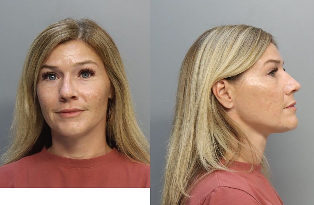 LUGO SHANNON MARIE 07/17/2024 - Miami-Dade County Mugshots Zone